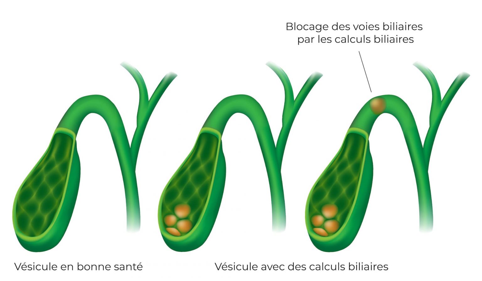 Perrine Mathonet | Vésicule