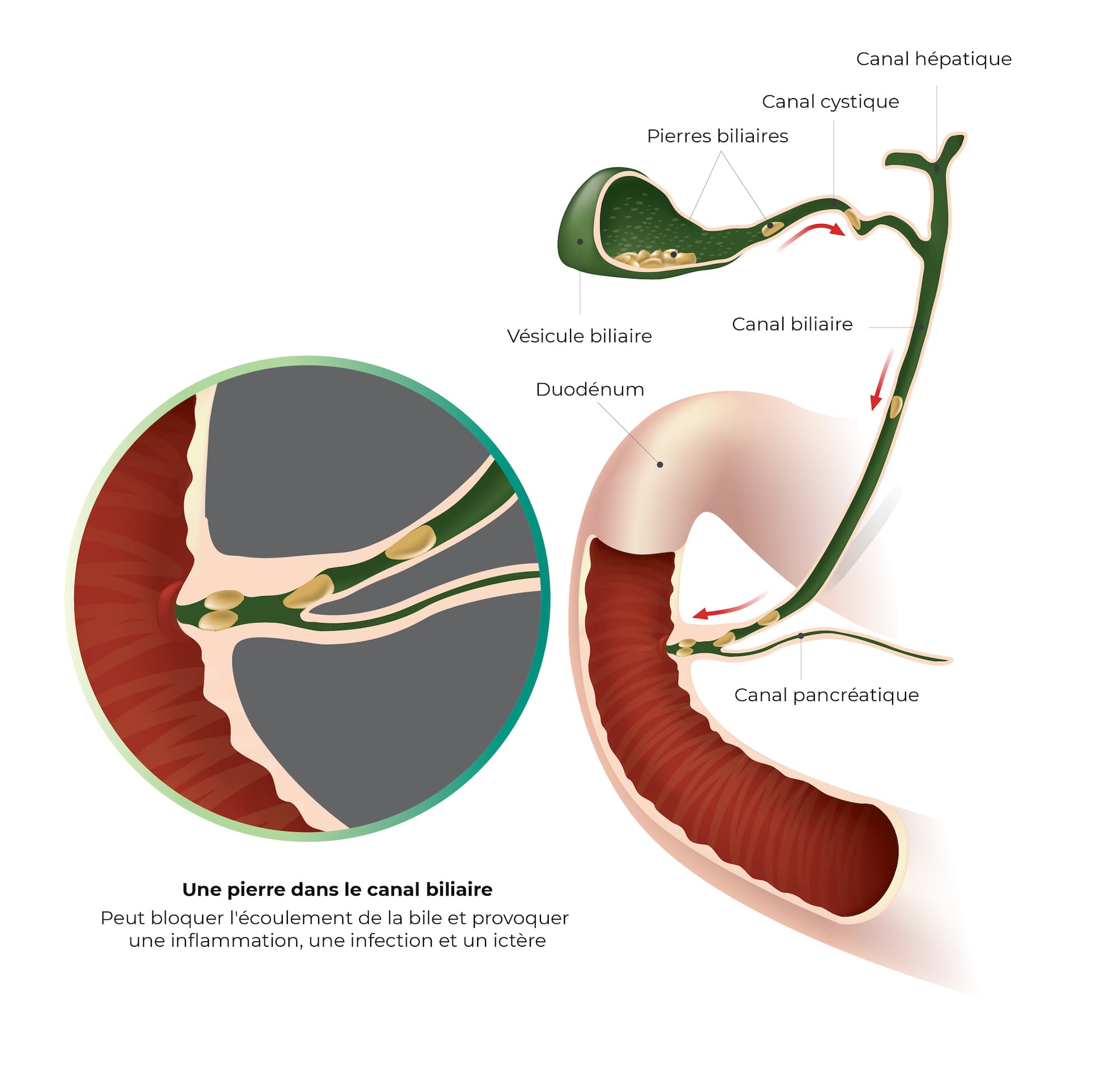 Perrine Mathonet | Vésicule
